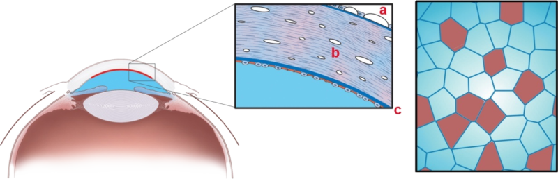 DSAEK Corneal Transplantation | Dr. John Goosey